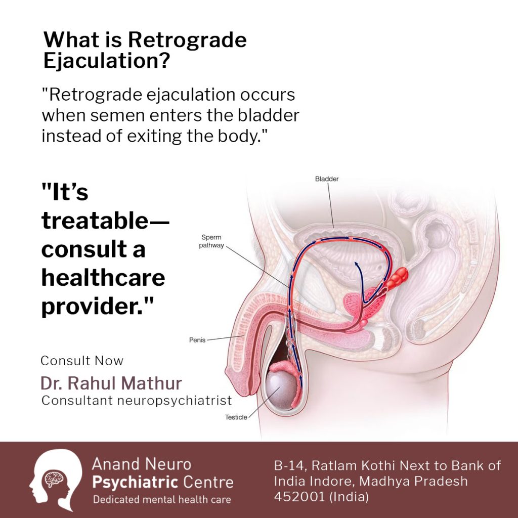 What is Retrograde Ejaculation?, Causes, Risk